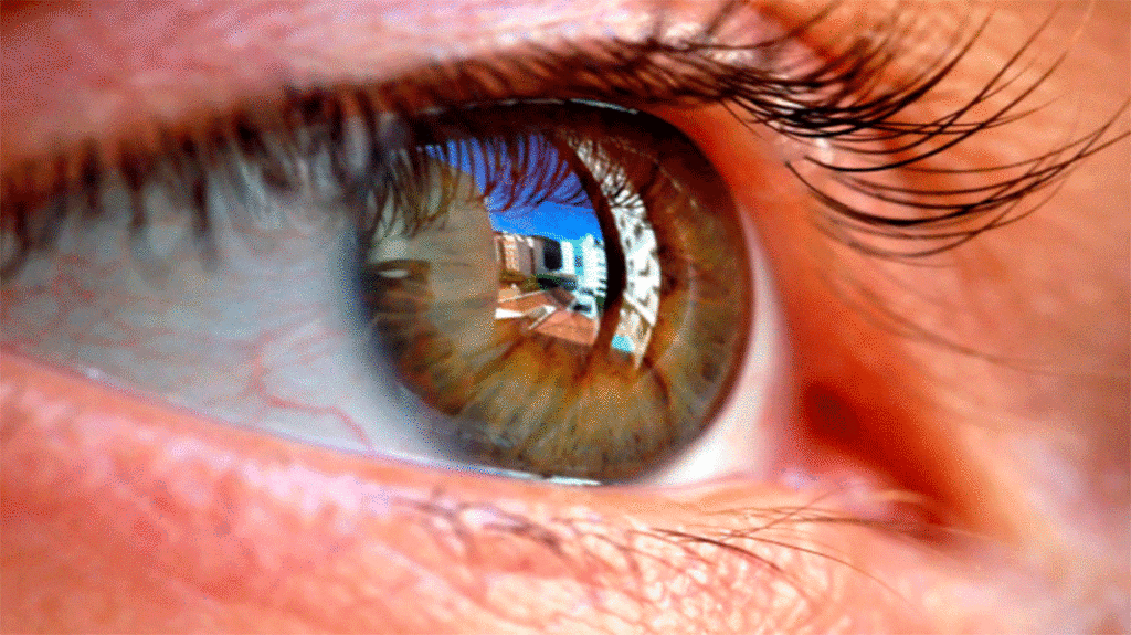 ¿Cuáles son los tipos de cáncer más frecuentes en los ojos? - Revista ...